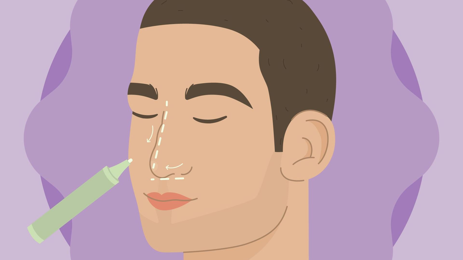 تعرّف على أسباب إجراء عملية حقن فلر الأنف | Daleeeel.com